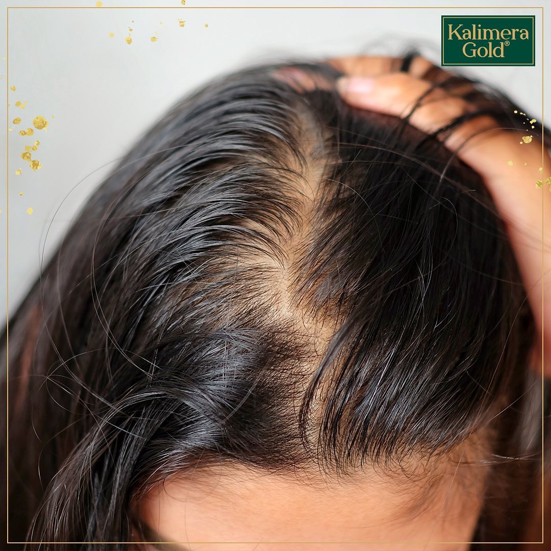 Best Hair Fall Control Oil for Both Male and Females